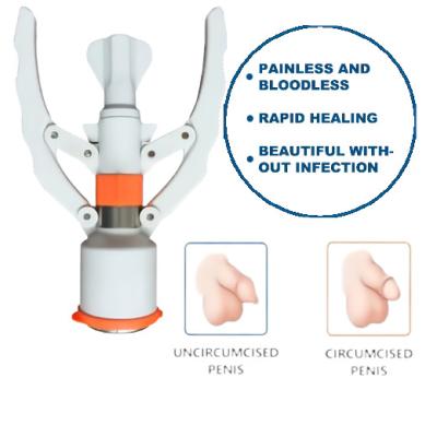 China ODM ZSR Disposable Circumcision Stapler for Anorectal Urology Surgery for sale