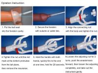 China Kids Adult Male Disposable Circumcision Stapler Clamps Surgery Device for sale