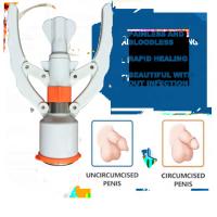 China Male Disposable Circumcision Stapler Kit For Foreskin Cutting customized for sale