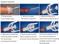 China 13mm Disposable Circumcision Stapler Forceps For Male Adults And Kids for sale
