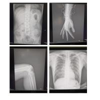 China Medical X Ray Equipment High Frequency Digital Portable X-Ray Machine 900KJ Heat Capacity for sale