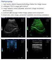 China 250mm Depth LED Display Medical Ultrasound Scanner for sale
