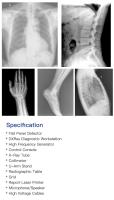 China 20KW 50KW Medical X Ray Radiological Equipment Lightweight for sale