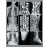 China 140KHU Radiography X Ray Equipment 2800r/Min High Frequency for sale