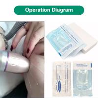 China Thread Protein Collagen Radar Line Carving Serum Protein Face Thread for sale