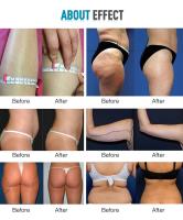 China 80K 40K Cavitation Body Sculpting Slimming Machine Beauty Salon Equipment for sale