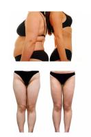 China Ultrasound 40k Weight Loss Cavitation Machine 7 In 1 for sale