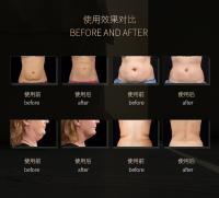 China 80k Body face Portable Cavitation Machine With Lipo Laser Pads for sale