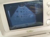 China Class II Ultrasonic Mindray Expert Pregnancy Scanner 65C15EA Microconvex Probe for Imaging for sale