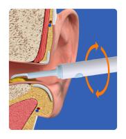 China 1080P HD Ear Cleaning Camera with 6 LED Lights 350mAh Rechargeable Otoscope for Adults for sale