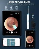 China 1080P HD Ear Wax Removal Kit with 1296P Otoscope Camera 350mAh Rechargeable Ear Cleaner for sale