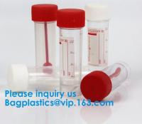 China Sterile Disposable Urine Specimen Cup 60ml 100ml PP Medical Sample Collection Container for sale