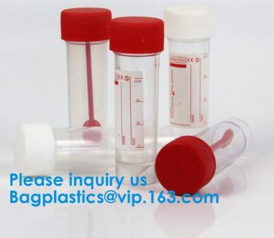 China Sterile Disposable Urine Specimen Cup 60ml 100ml PP Medical Sample Collection Container for sale