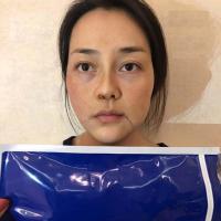 China Mono 27G 50mm PDO Thread Face Lift For Medical Skin Tightening Lips Threads for sale