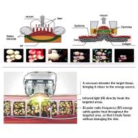 China Bipolar Rf Fast Slimming Machine 40khz Ultrasonic Cavitation Vacuum Massage for sale