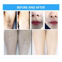 China Permanent Ice 1064nm Hair Removal Beauty Machine Triple Wavelengths Diode Laser for sale