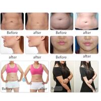 China RF Cryolipolysis Fat Freezing Machine 800W , Multifunctional Fat Loss Machine for sale