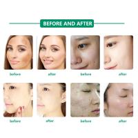 China Portable Facial Beauty PDT LED Light Therapy Machine ABS Material for sale