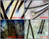 China 650nm Hair Growth Laser Light Device , 90Hz Light Therapy Machine Professional for sale
