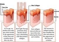 China Face Body PDT Light Therapy Device ,  660nm Red Light Therapy Equipment for sale