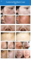 China 7 In 1 Professional Water Oxygen Jet Peel Machine Facial Deep Cleaning for sale