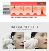 China HIFU Beauty Machine 5.0-25mm Portable Skin Tightening Device for sale
