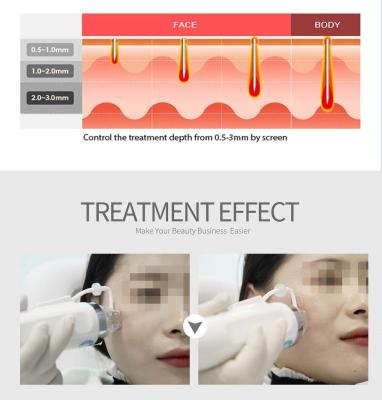 China HIFU Beauty Machine 5.0-25mm Portable Skin Tightening Device for sale