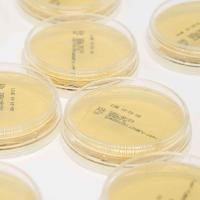 China Sterile Prepared Agar Plates Cetrimide Agar CA Media Plate For Selective Detection for sale