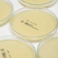 China Sterile Prepared Agar Plates Cetrimide Agar CA Media Plate For Selective Detection for sale