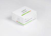 China 10min Neutrophil Gelatinase Associated Lipocalin NGAL Test Kit 50-5000ng/ML for sale