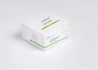 China Beta 2 Microglobulin Glycosylated Hemoglobin Test Kit 0.5-20mg/L 15min for sale