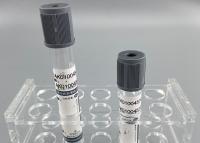 China 5ml Sodium Fluoride Potassium Oxalate Tube for sale