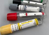 China Disposable Blood Vacuum Container For CRP Digoxin Concentration for sale