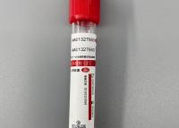 China No Anticoagulant 2ml Blood Vacuum Container Common Rapid Serum Tube for sale