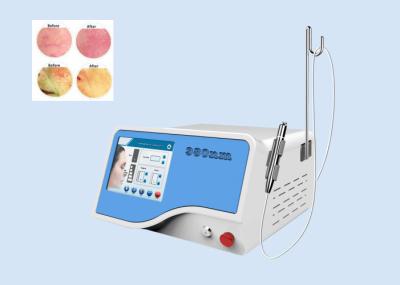 China 30W 980 nm Diode Laser Vascular Lesions Red Blood Vessels Spider Veins Removal Machine for sale