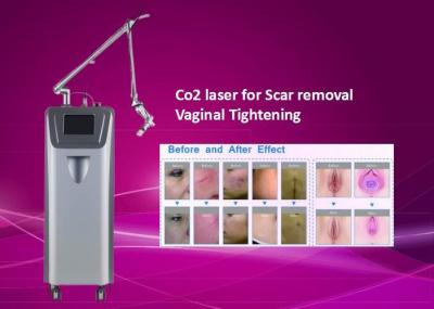 China Acne Scars Removal Dermatological Surgery Fractional Co2 Laser Machine for sale