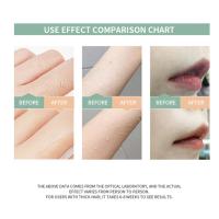 China Permanent Painless Home Ipl Portable Laser Hair Removal Device Handset For Women Men for sale