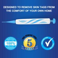 China Handheld Clear Auto Skin Tag Remover Kit Stopping Skin Tags Blood ODM for sale