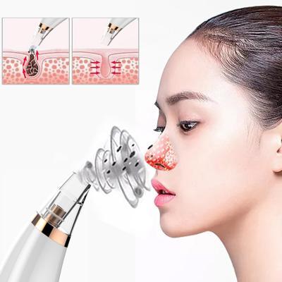 China OEM ABS Plastic Electric Facial Pore Cleaner Vacuum Acne Blackhead Remover for sale