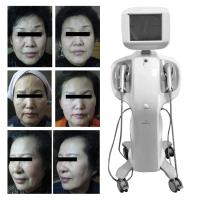 China Dual Handle Ultrasound Hifu Anti Wrinkle Rf Facial Machine 7D At Home for sale