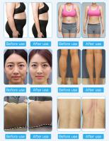 China Weightloss 6 In 1 RF 40k Cavitation Ultrasonic Lipo Laser Body Slimming Vacuum Machine for sale