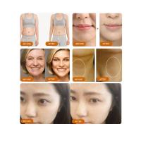 China 1.5mm Face Lift 7D HIFU Beauty Machine for sale