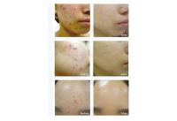 China 4.3'' Screen 7 Colors Led Pdt Light Facial Therapy Machine Face Care Skin Care for sale