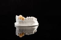 China Ultra Translucent Layered Zirconia 3d Pro Zirconia For Dental Lab for sale