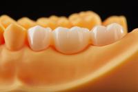 China SHT-ML Multilayer Zirconia Blocks Dental Material For CAD CAM Crown Bridge for sale