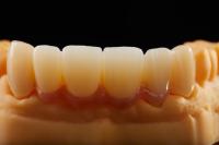 China 3D Multilayer Zirconia Dental Block Natural Color Gradient for Anterior Teeth for sale