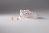 China Dental Zirconia Multilayer Block Pre Shaded for Aesthetic Crown Bridge for sale