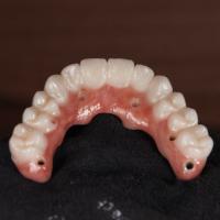 China Alpha+ Dental Zirconia Block Full Arch All Around 800 Mpa Strength for sale