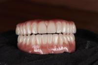 China 45%-56% Translucency Dental Zirconia Block Ceramic Material For Dental Lab 800Mpa for sale