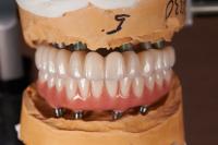 China Alpha+ CAD CAM Zirconia Block 5D Multilayer Gradient Dental Zirconia Disc for sale